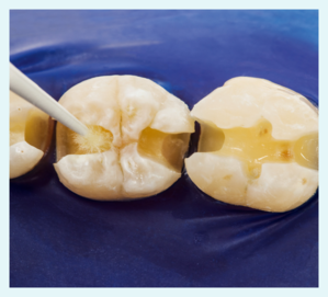 Ecosite Bond. Secure bond, total freedom.