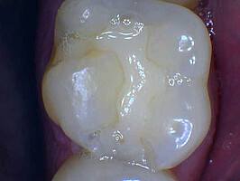 Ecosite One: The innovative layering composite by DMG.