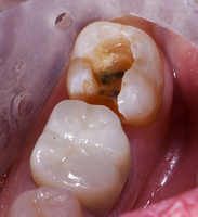 Ecosite One: The innovative layering composite by DMG.