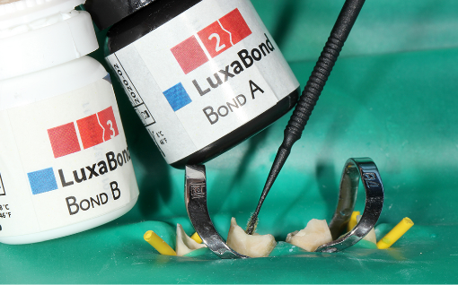 LuxaBond Total Etch, the dual-curing adhesive system